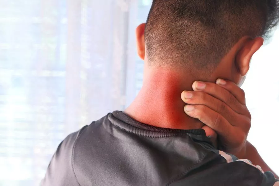 Bagaimana Mengatasi Bintik Merah Gatal Menyebar di Leher?